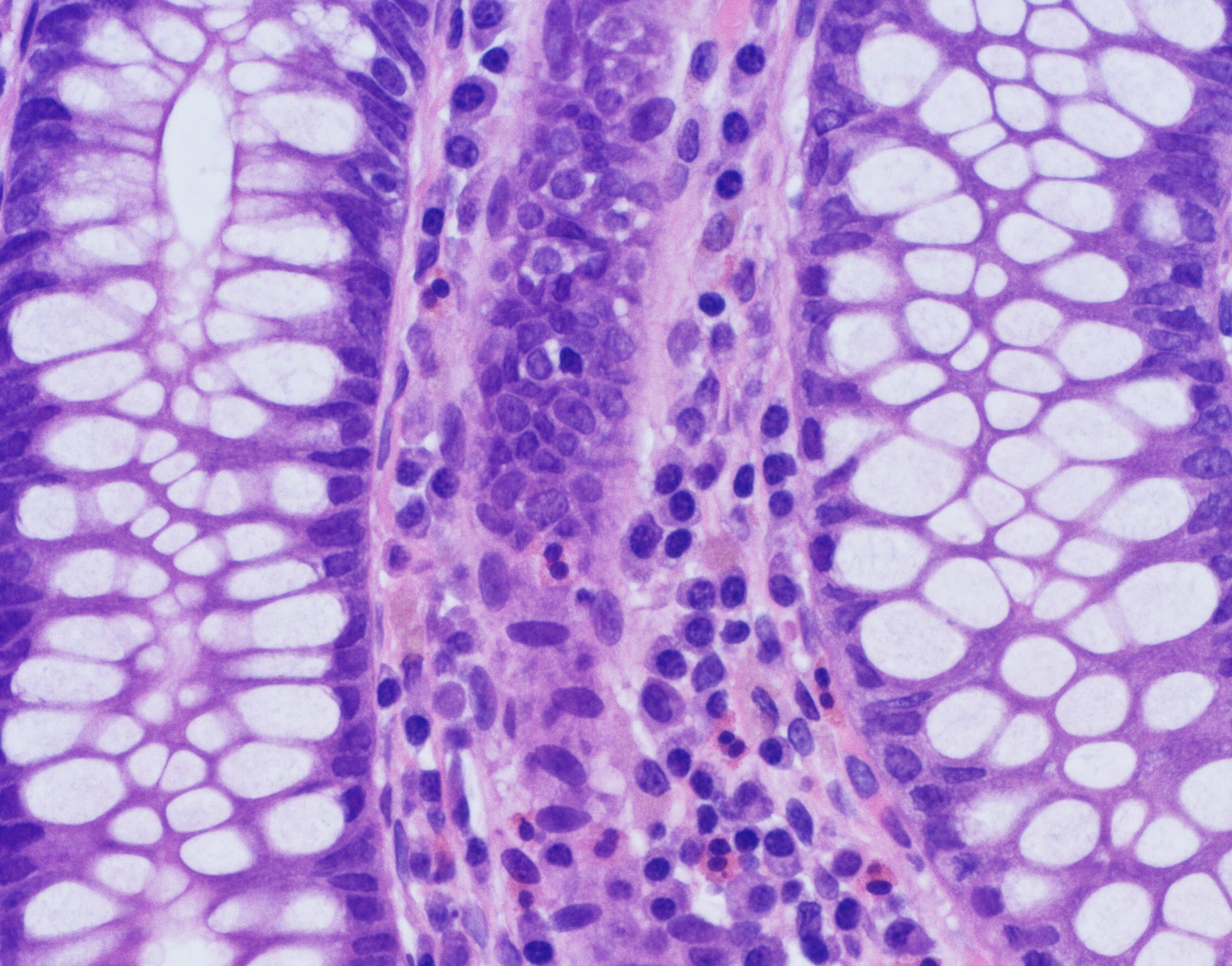 Colon Histology Labeled
