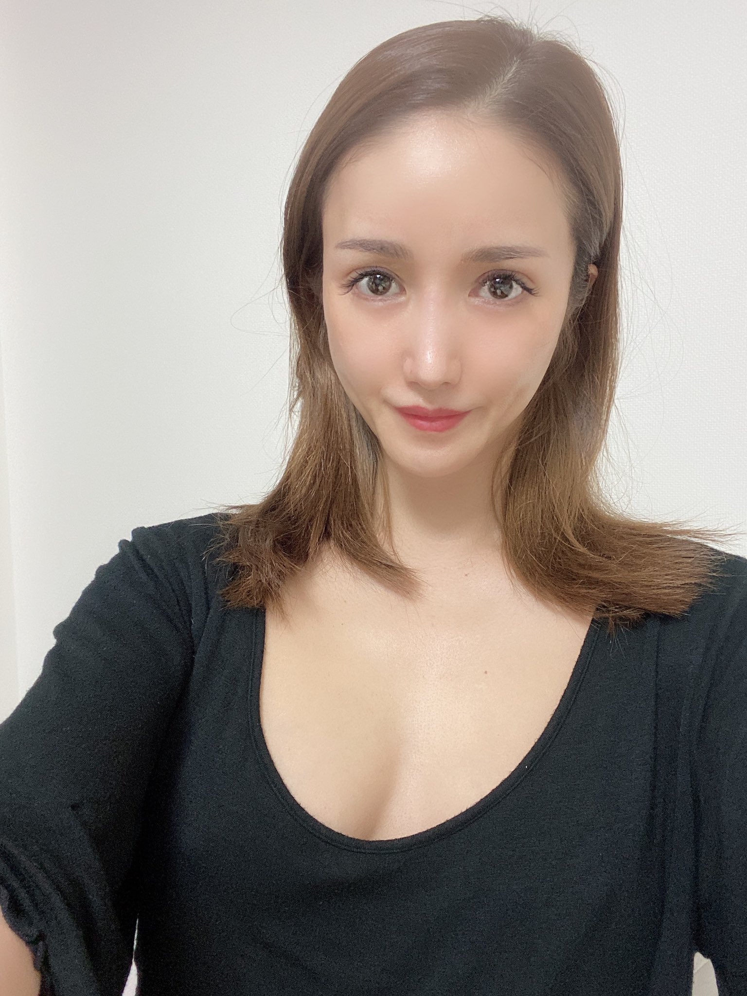 木村さん On Twitter 眼瞼下垂してから3週間 左右差が気になるので来月カウセ Vhxrvihazq Twitter