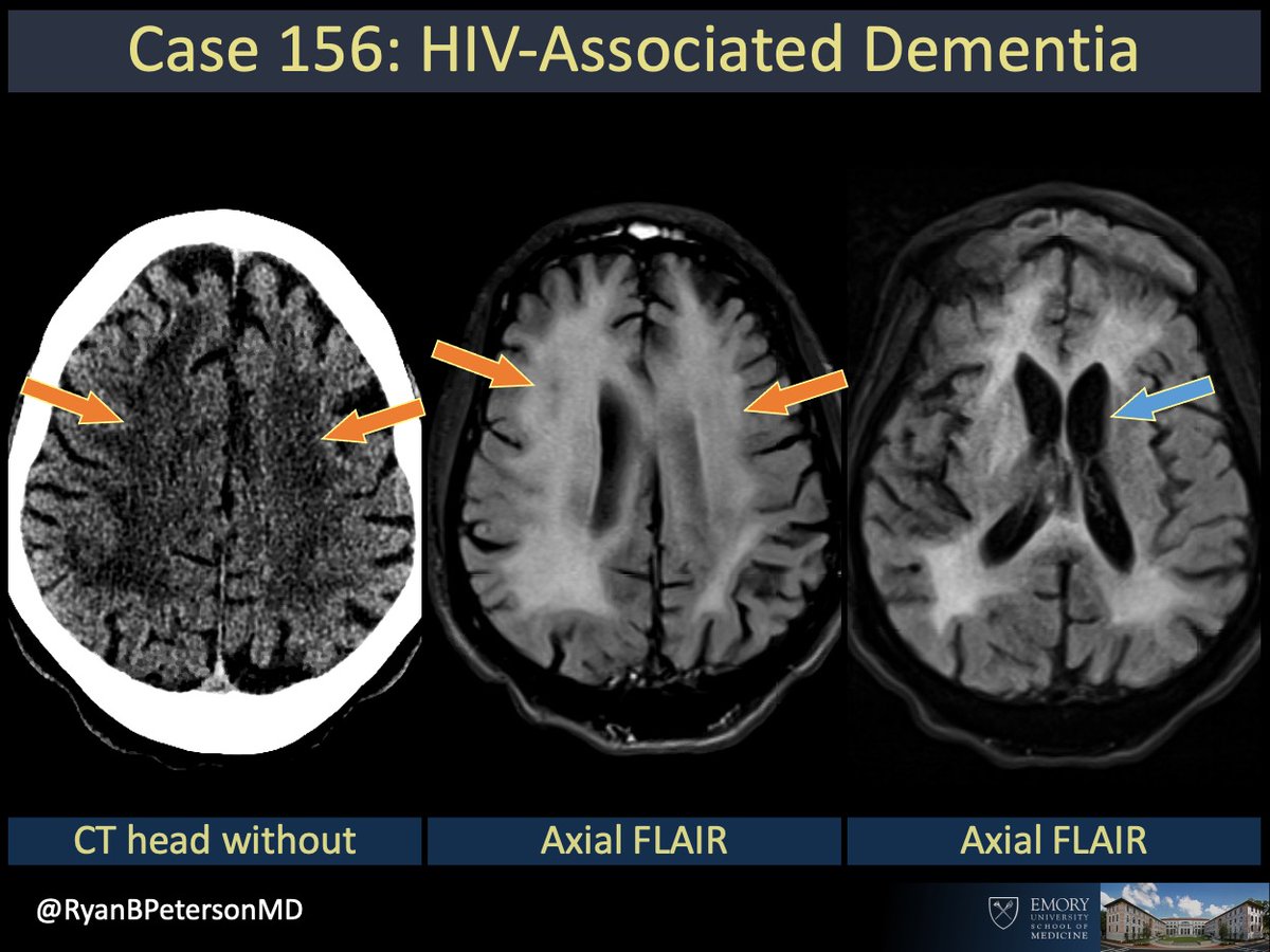 Emory Radiology COTD #156 Hx: Younger patient