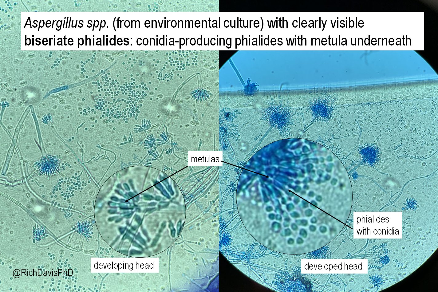 Aspergillus Labeled Under Microscope
