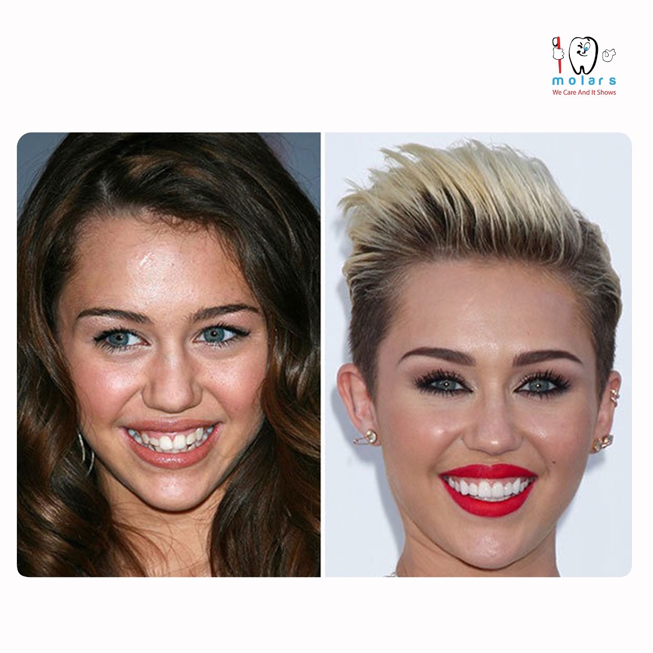 Before And After Miley Cyrus