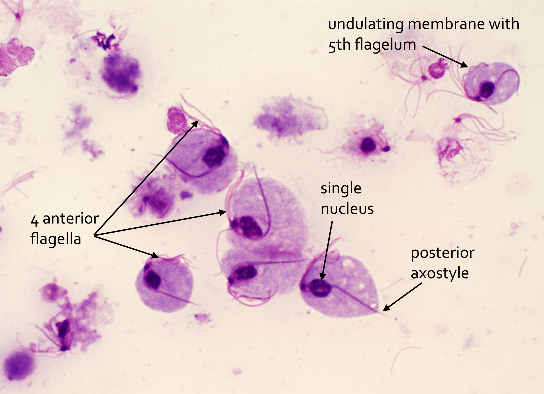 Trichomonas Slide
