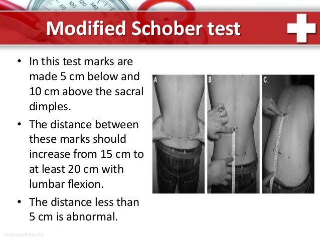 Schober Test