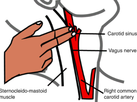 Syncope: Etiology and diagnostic approach. Excellent review article ...