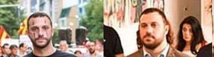 Coke Bloat Face Before And After