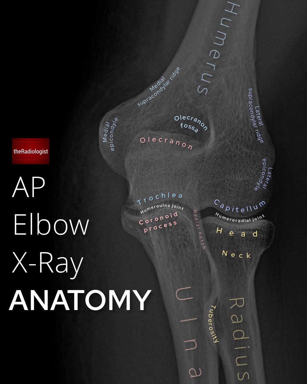 Elbow X Ray