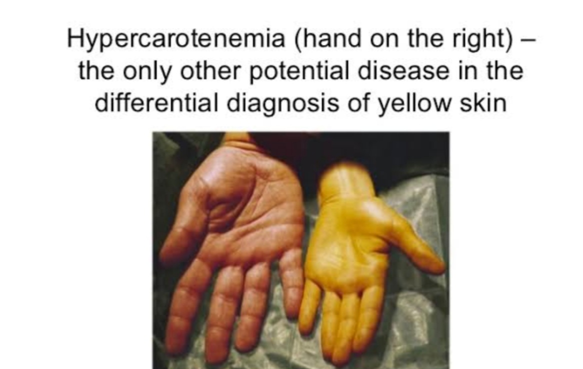 Hypercarotenemia
