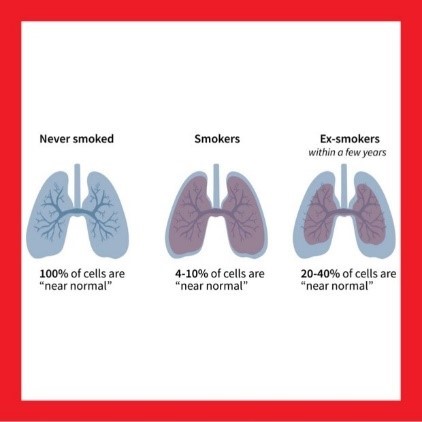Ex Smokers Lungs