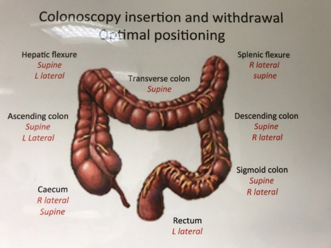 Splenic Flexure Colonoscopy