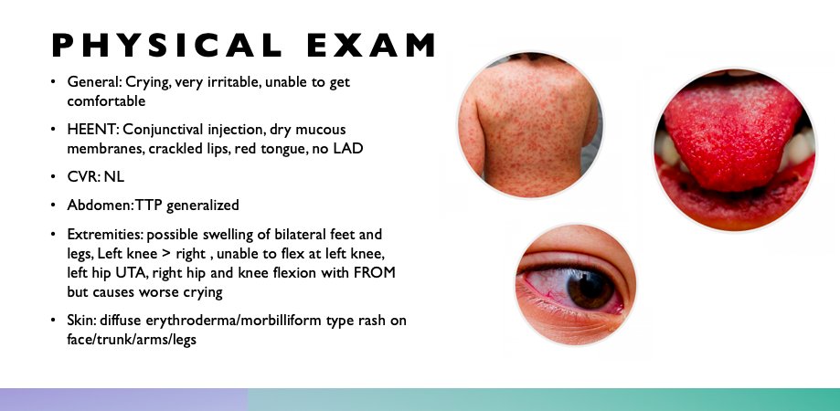 Dry Mucosal Membranes