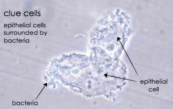 Clue Cells
