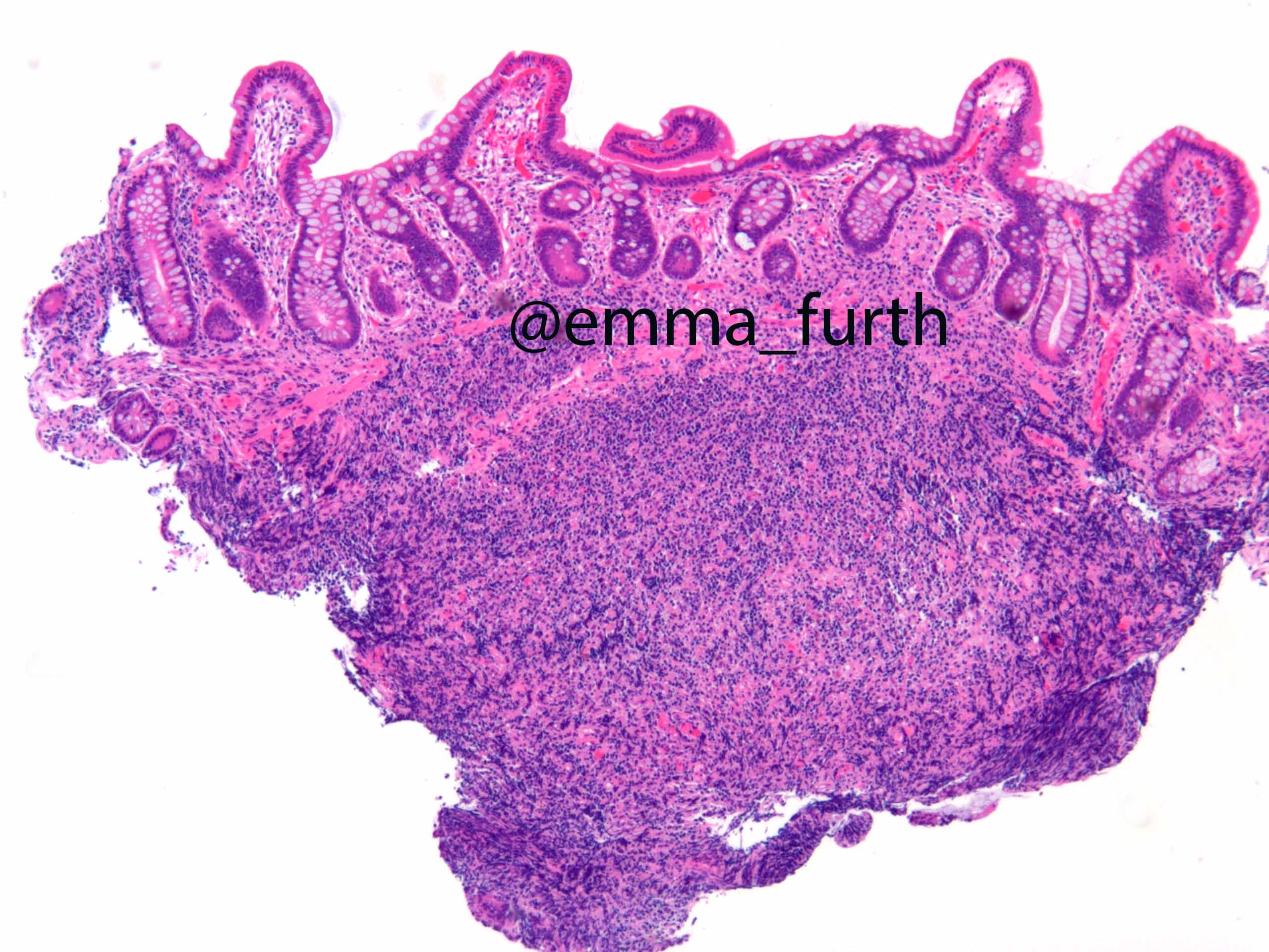 Pathology Outlines Histology-small Intestine, 51% OFF Pathology Outlines Histology-small Intestine, 51% OFF