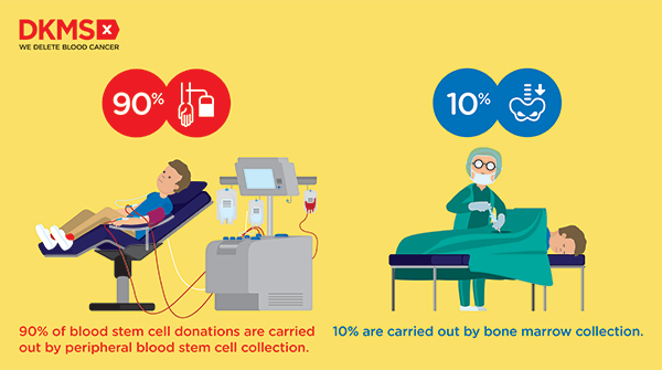 Peripheral Blood Stem Cell Donation