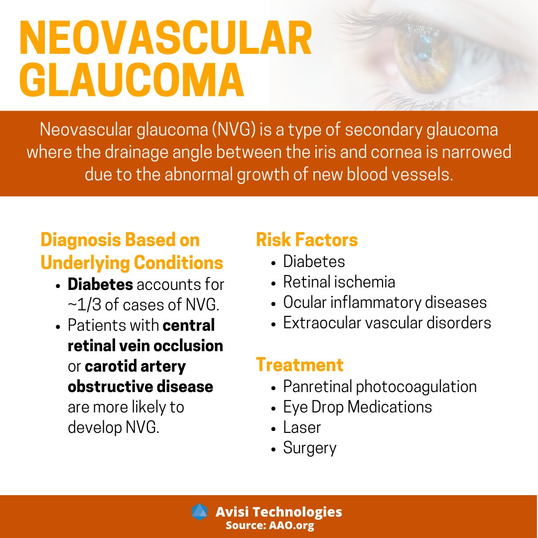 Neovascular Glaucoma