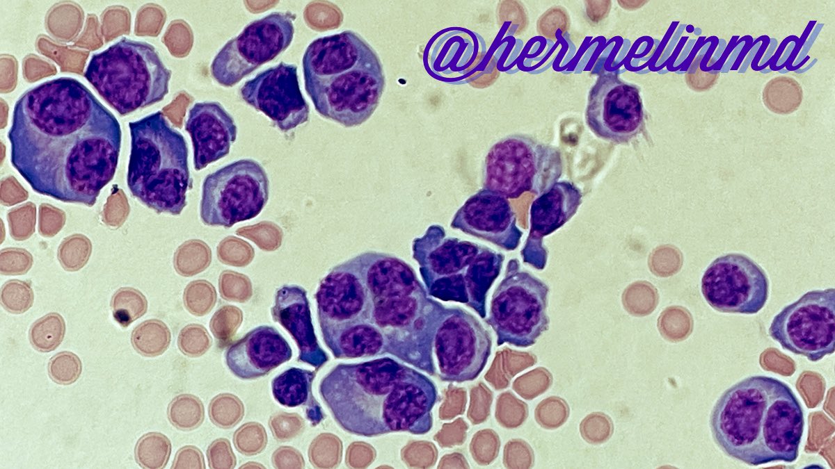 Pleural Fluid Cells Images