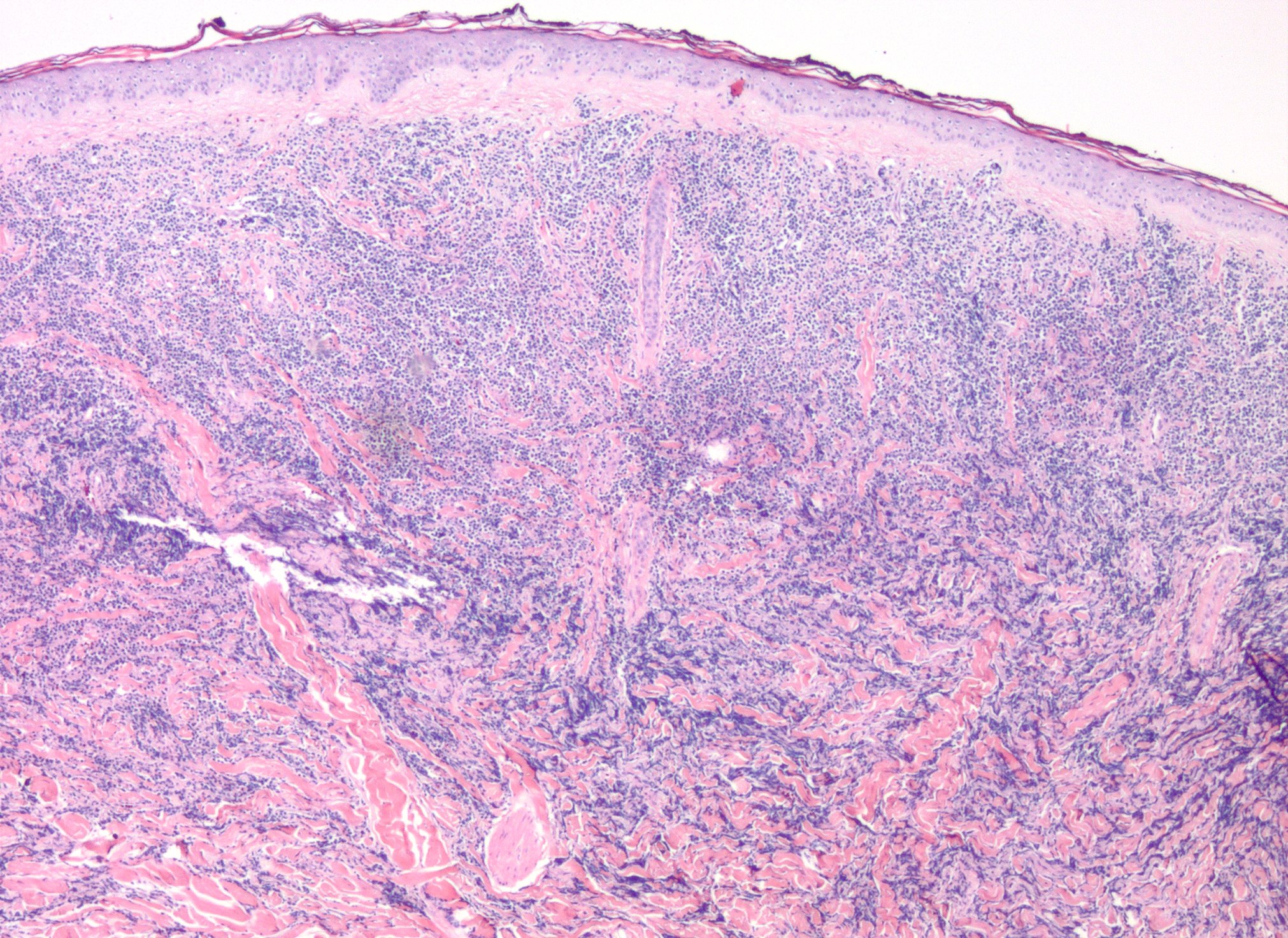 Dendritic Cells Histology