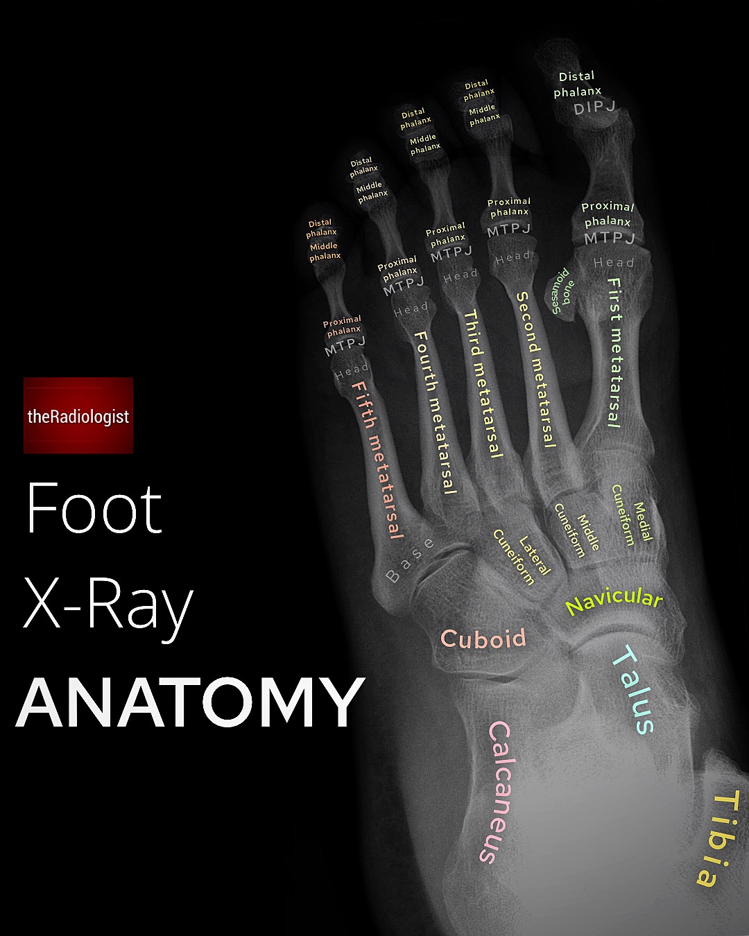 Foot Xray Anatomy Biomechanical Implications Of Congenital Conditions