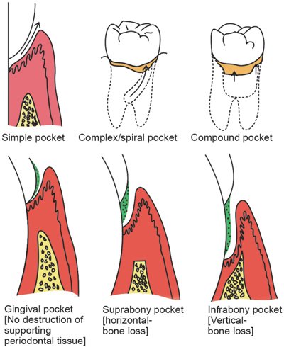 Cortical Bone Teeth