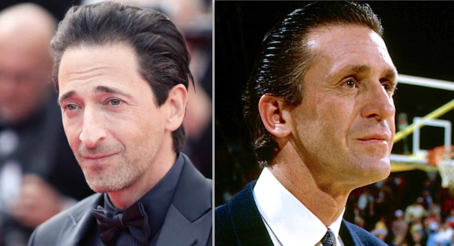 Adrien Brody Nose Job Before After