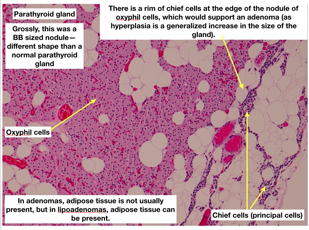 Parathyroid Histology Chief Cells