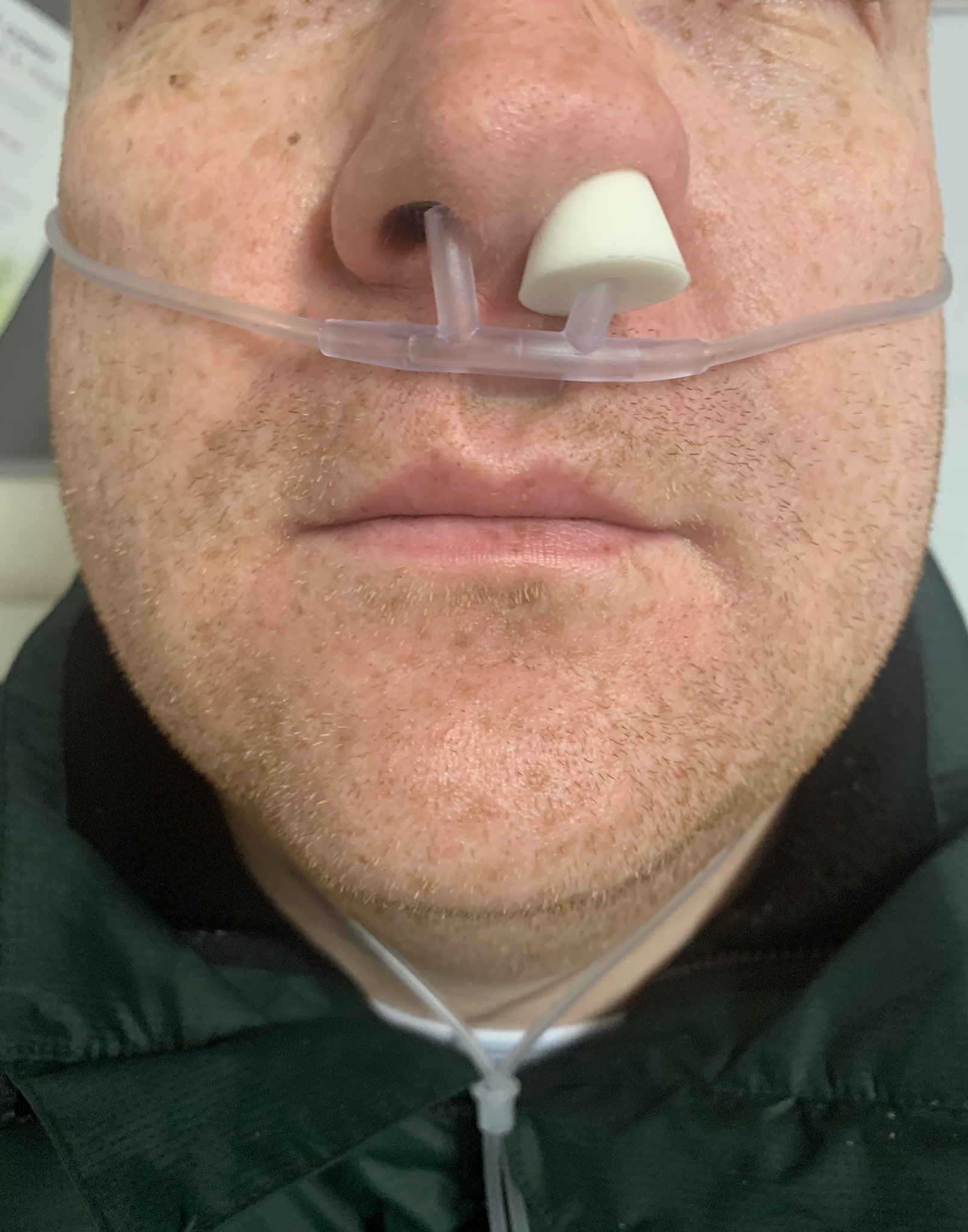 Nasal Cannula Placement