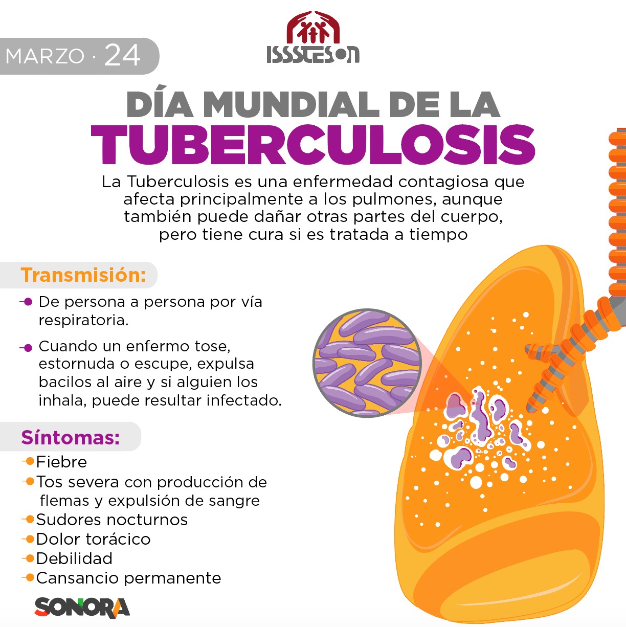 Tos Con Sangre Tuberculosis