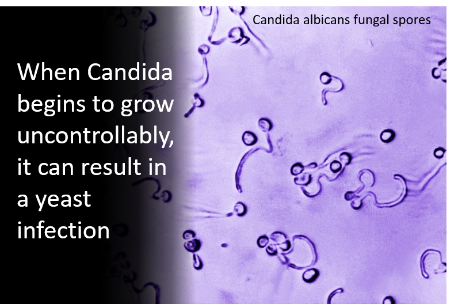Vaginal Yeast Under Microscope
