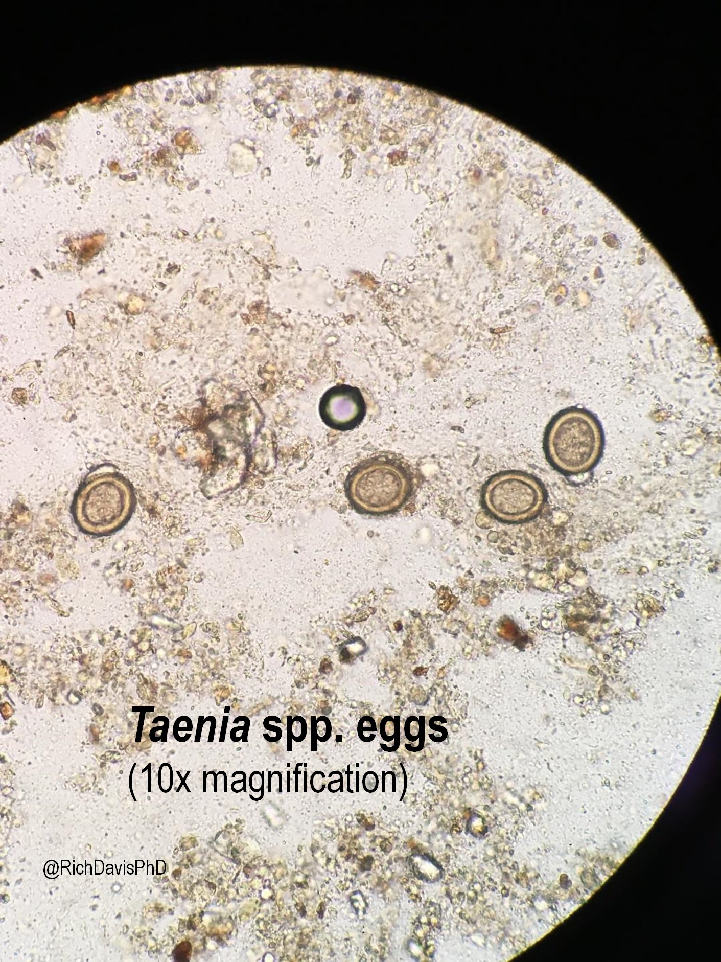 Roundworm Eggs Under Microscope