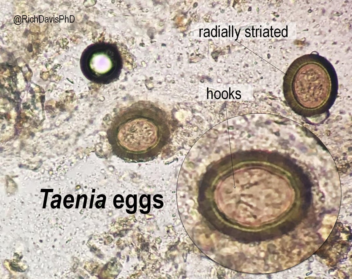 Taenia Solium Eggs