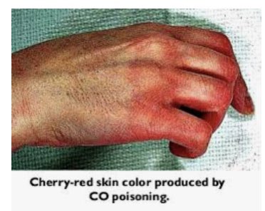 Carbon Monoxide Poisoning Skin