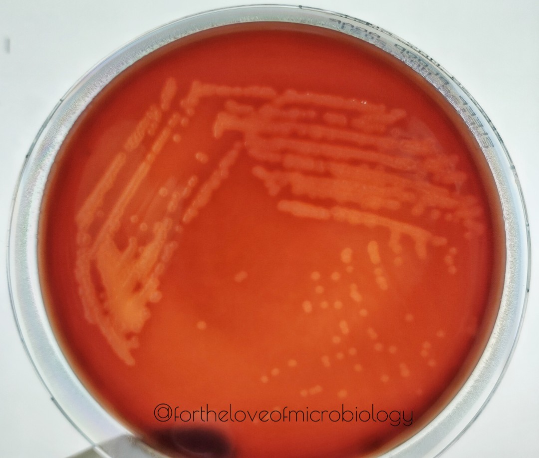 Kingella Growth On Blood Agar