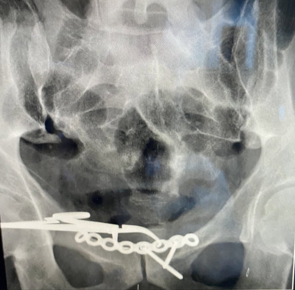 What will you do for this 50yo active male with an isolated closed ...