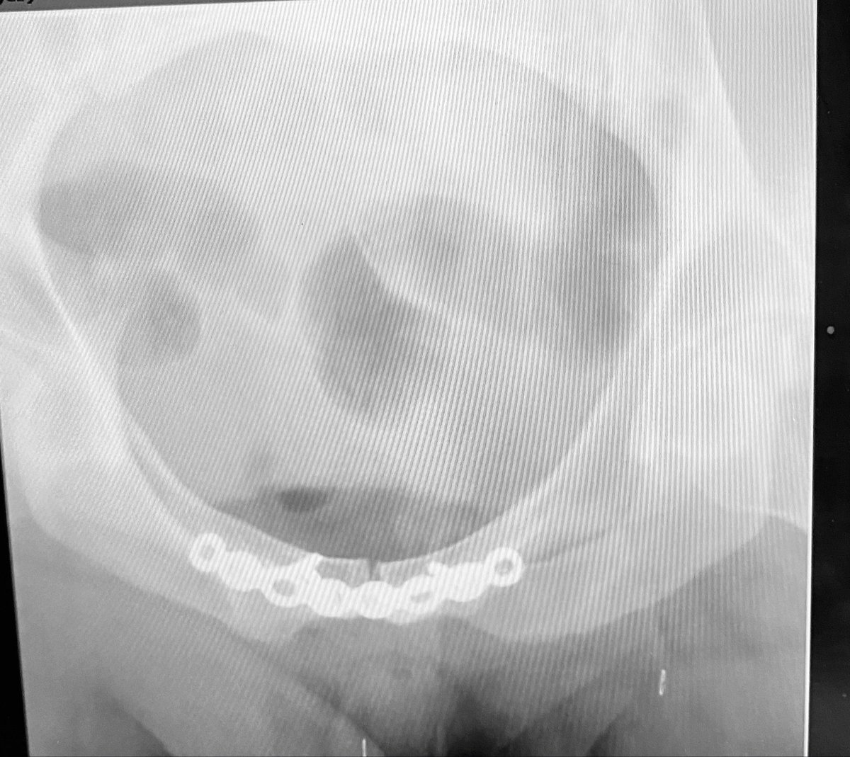 What will you do for this 50yo active male with an isolated closed ...