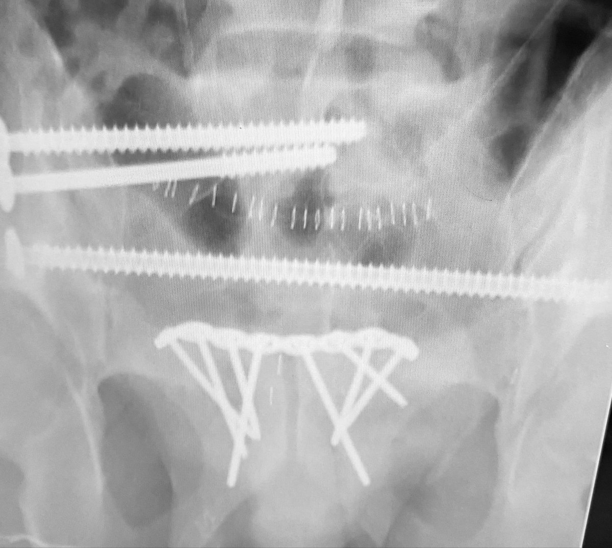 What will you do for this 50yo active male with an isolated closed ...