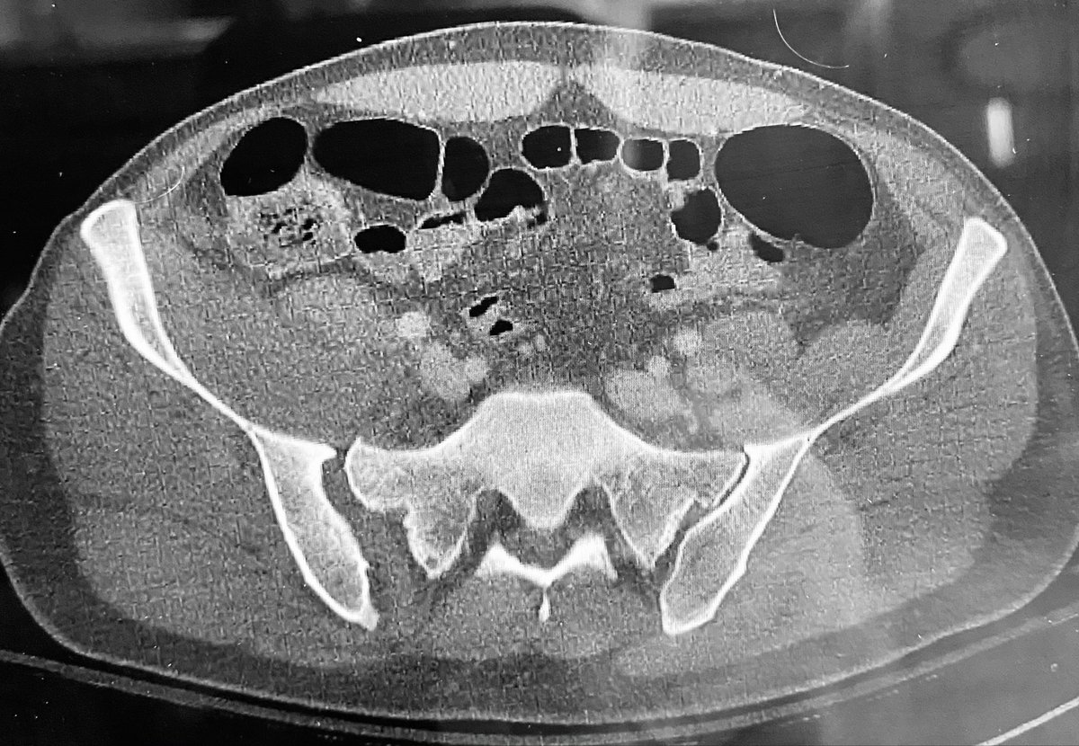 What will you do for this 50yo active male with an isolated closed ...