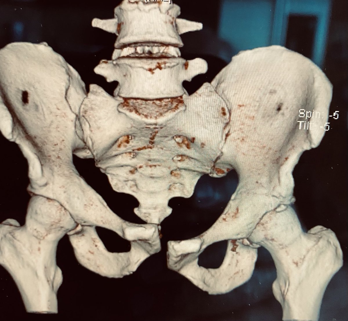 What will you do for this 50yo active male with an isolated closed ...