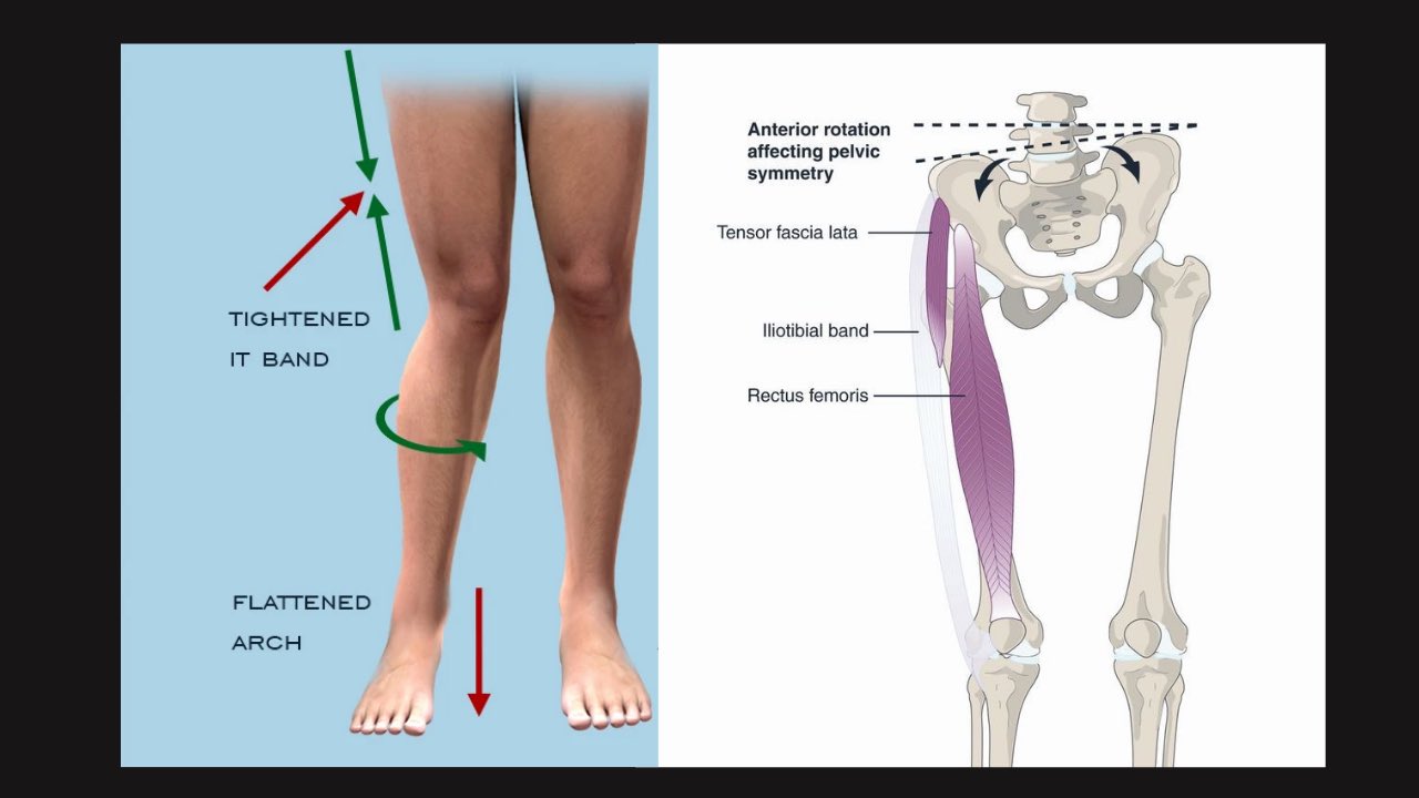 Internal Rotator Muscles