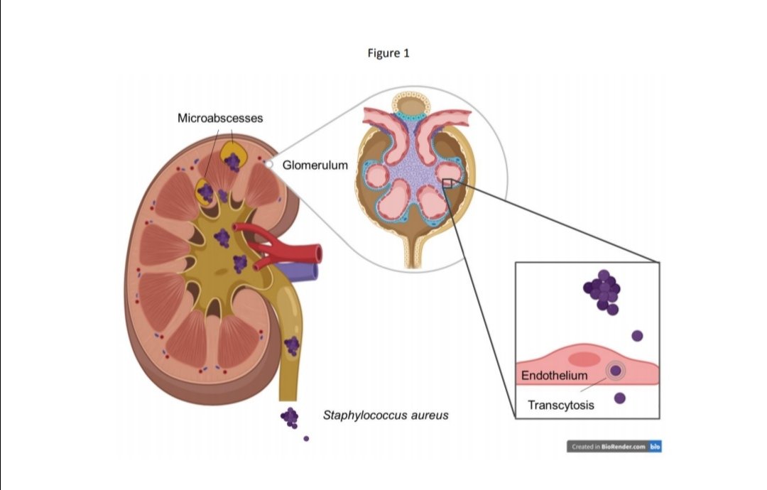 Staphylococcus Diagram