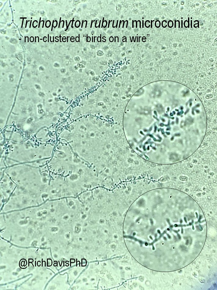 Microconidia