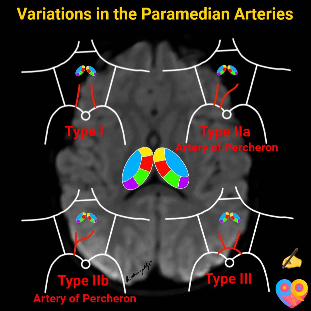 Paramedian Artery