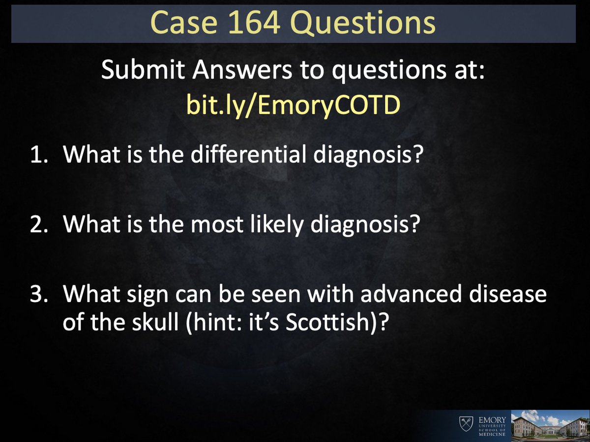 Emory Radiology COTD #164 Hx: Stroke alert. Altered mental status NO ...