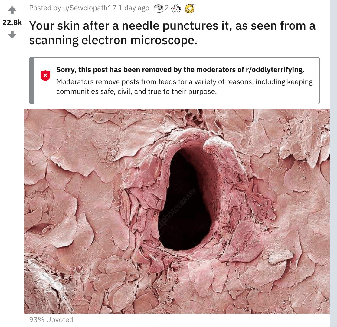 Tattoo Needle In Skin