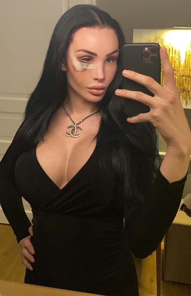 TS Kimberlee on Twitter: "Recovery is going well…