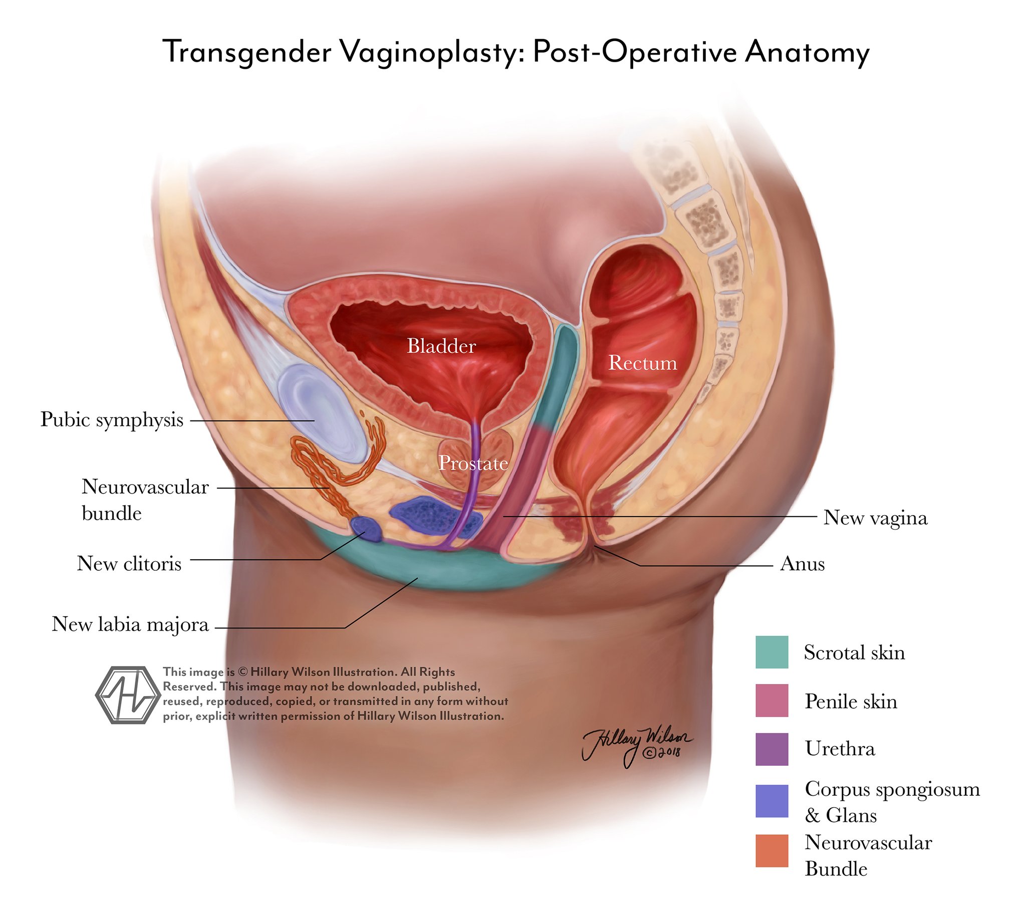 Transgender Anatomy Diagram