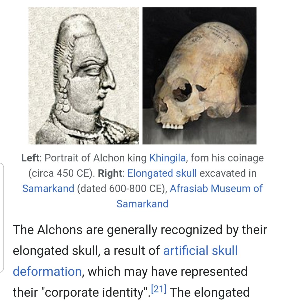 Elongated Skulls