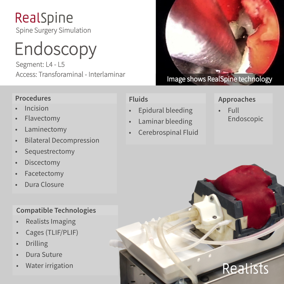 Realists GmbH on Twitter: "RealSpine Endoscopy anatomical cartridge: Herniated Disc + Stenosis ...