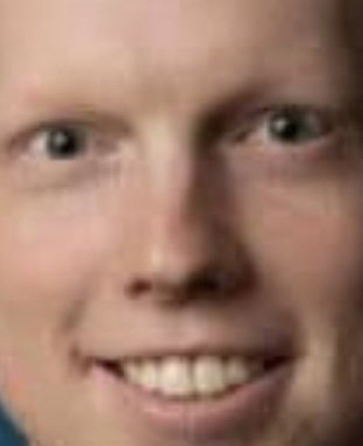 Guy With No Eyebrows
