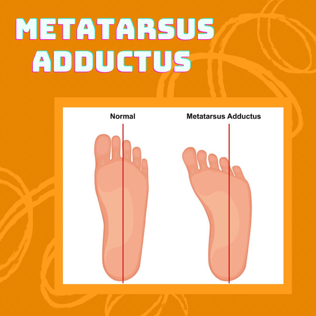 Adduction Of Foot