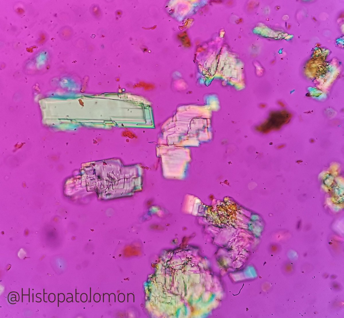 Polarized Cholesterol Crystals