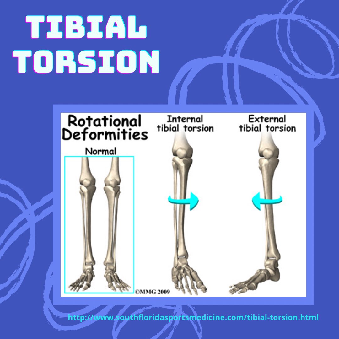 Tibial Internal Rotation